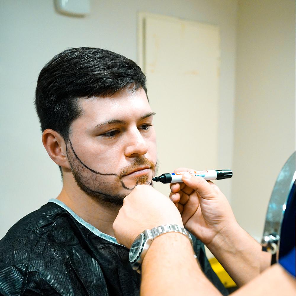 Beard Transplant Turkey - Hermest Clinic